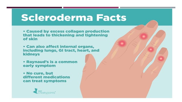 collagen and its disorders _.pdf