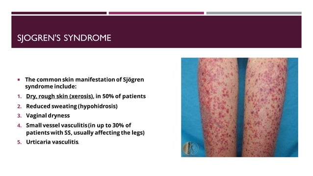 collagen and its disorders _.pdf