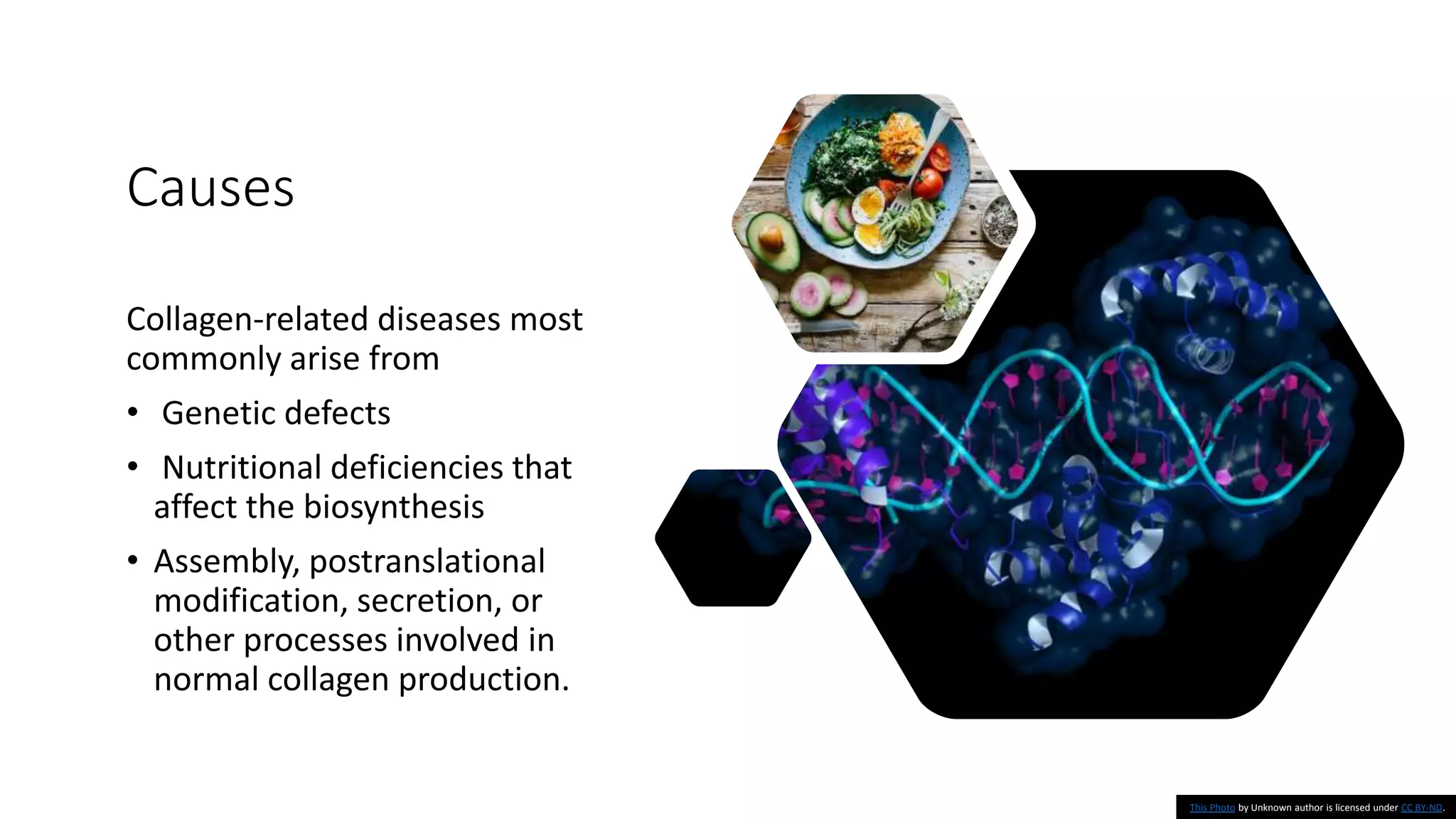 Collagen diseases.pptx