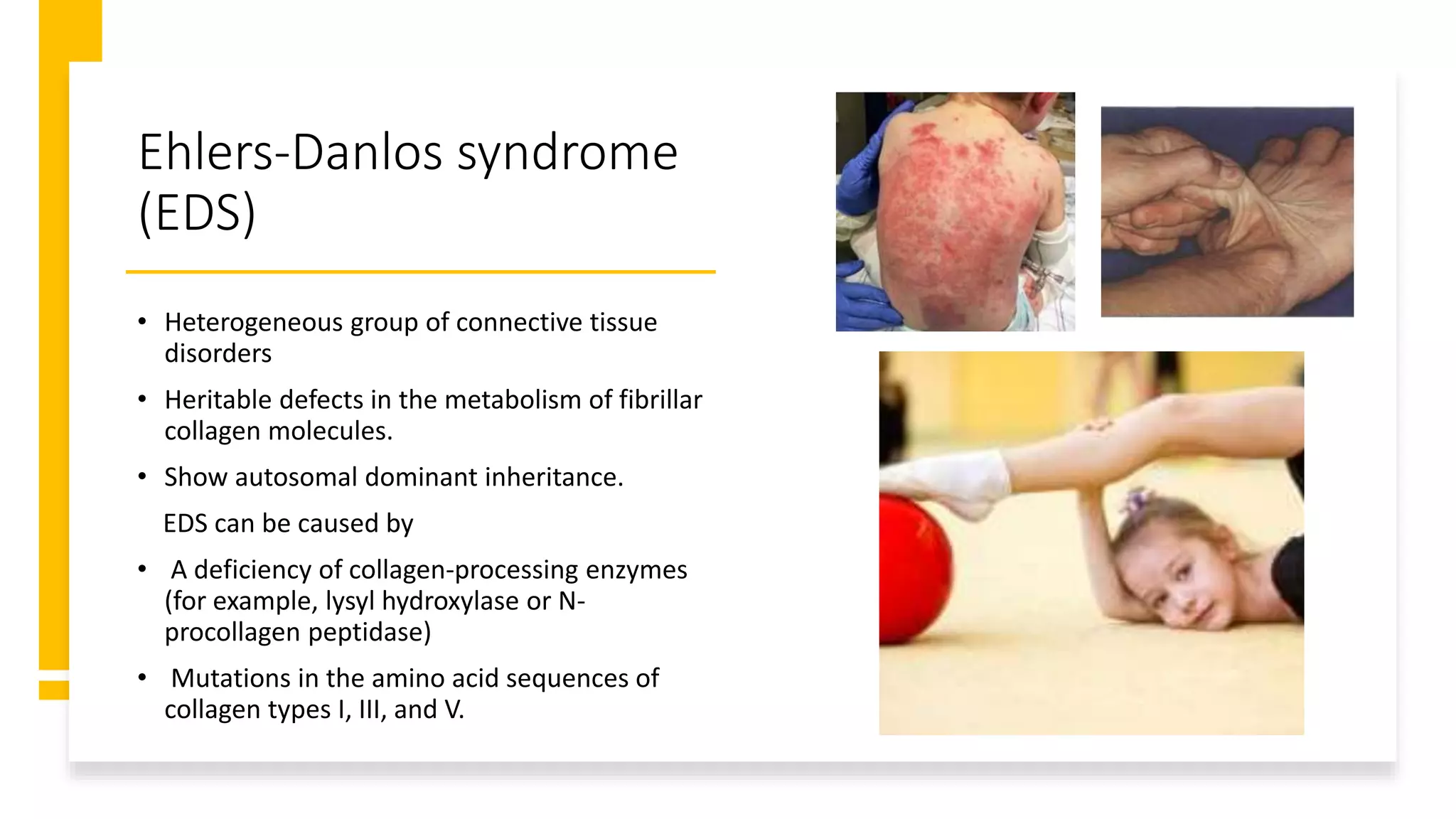 Collagen diseases.pptx
