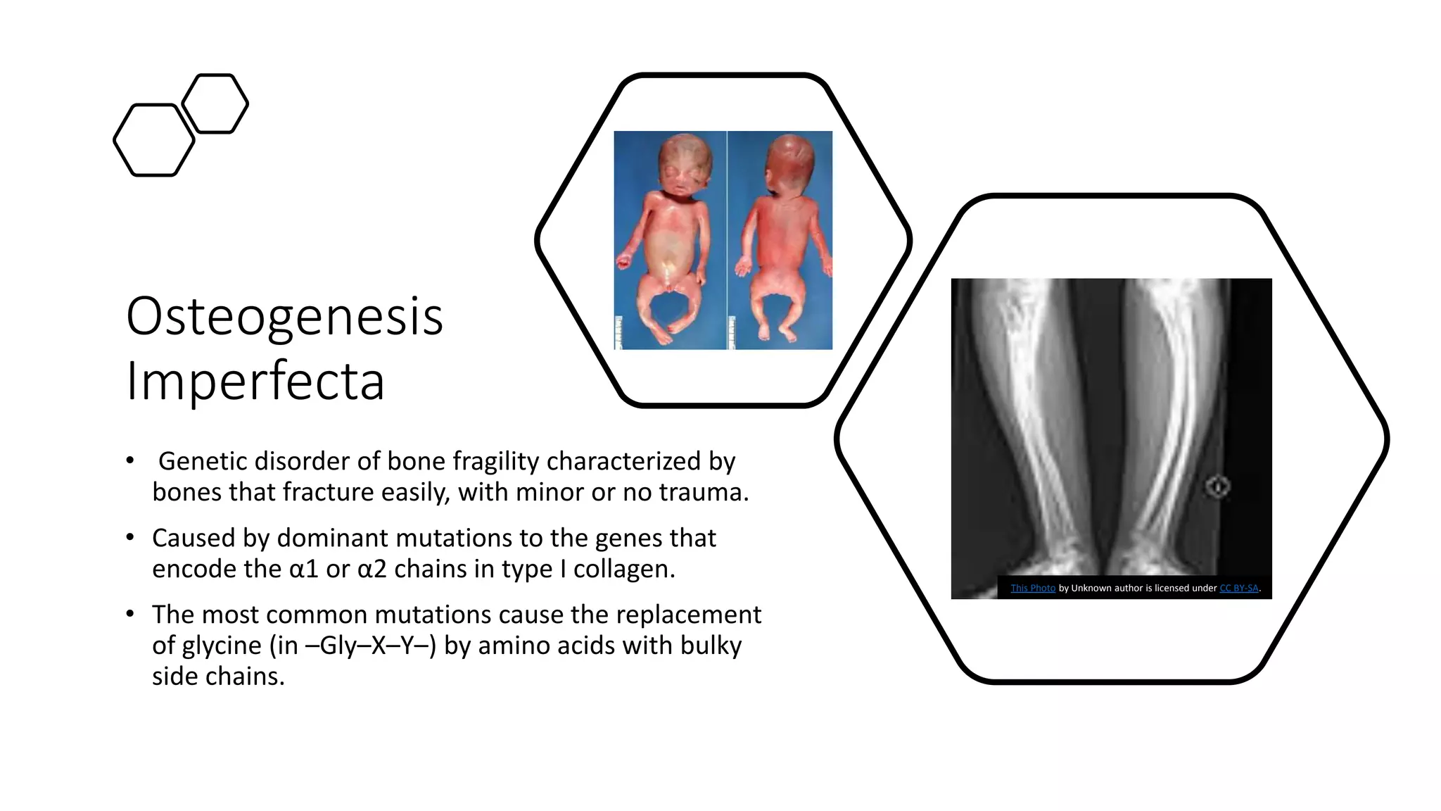 Collagen diseases.pptx