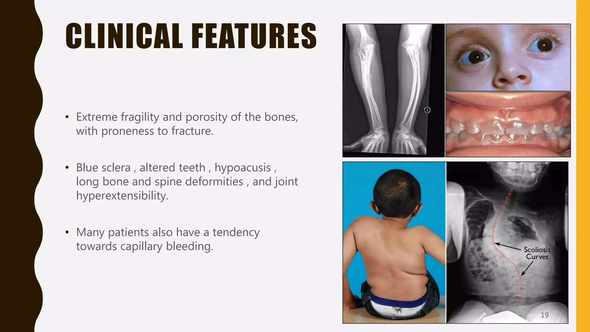 collagen disorders.pptx