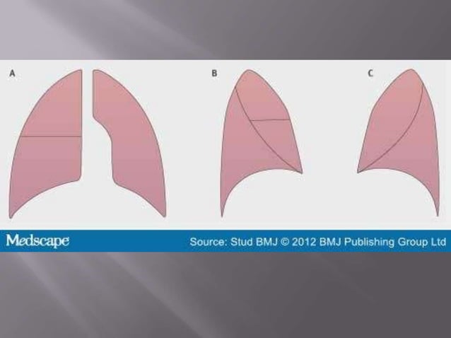 Collapse- RADIOLOGY | PPTX