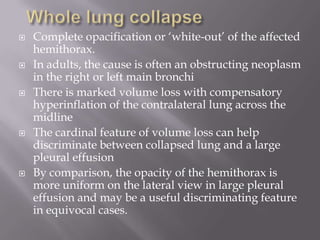 Collapse- RADIOLOGY | PPTX