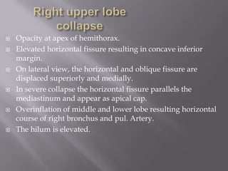 Collapse- RADIOLOGY | PPTX