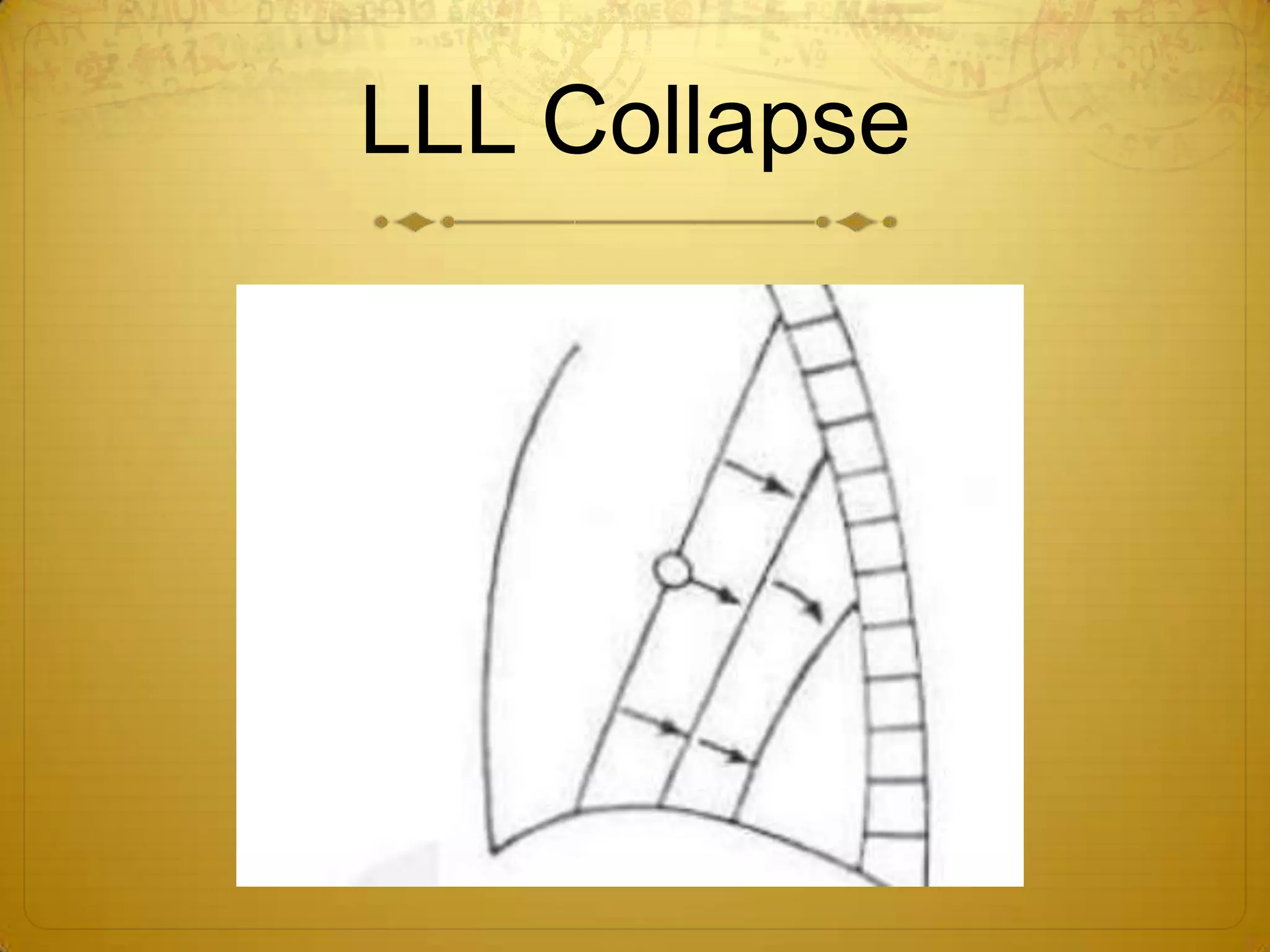 Collapse & consolidation made simple - chest X-rayz | PPTX