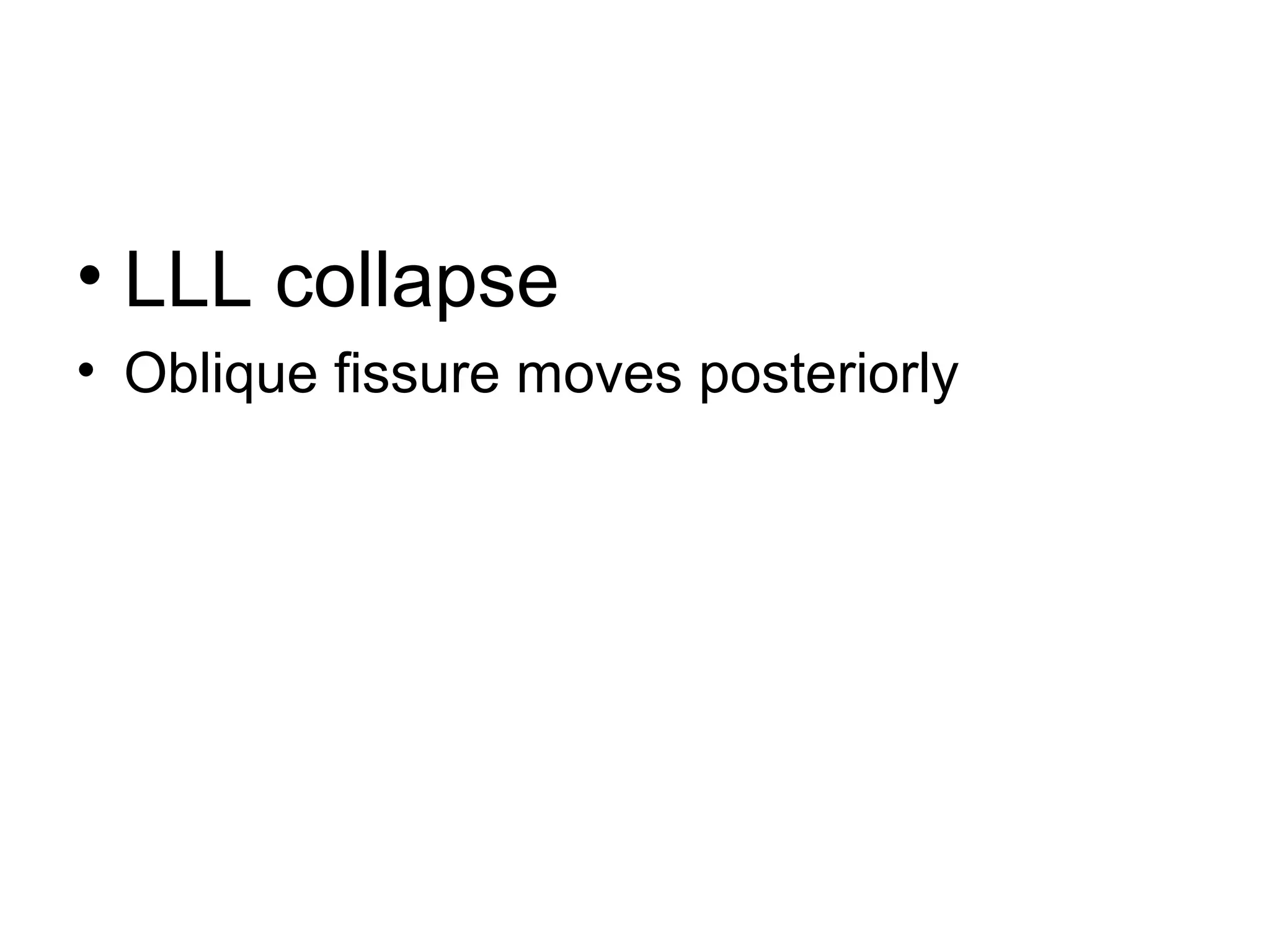 Collapse and consolidation Lung Radiology | PPT