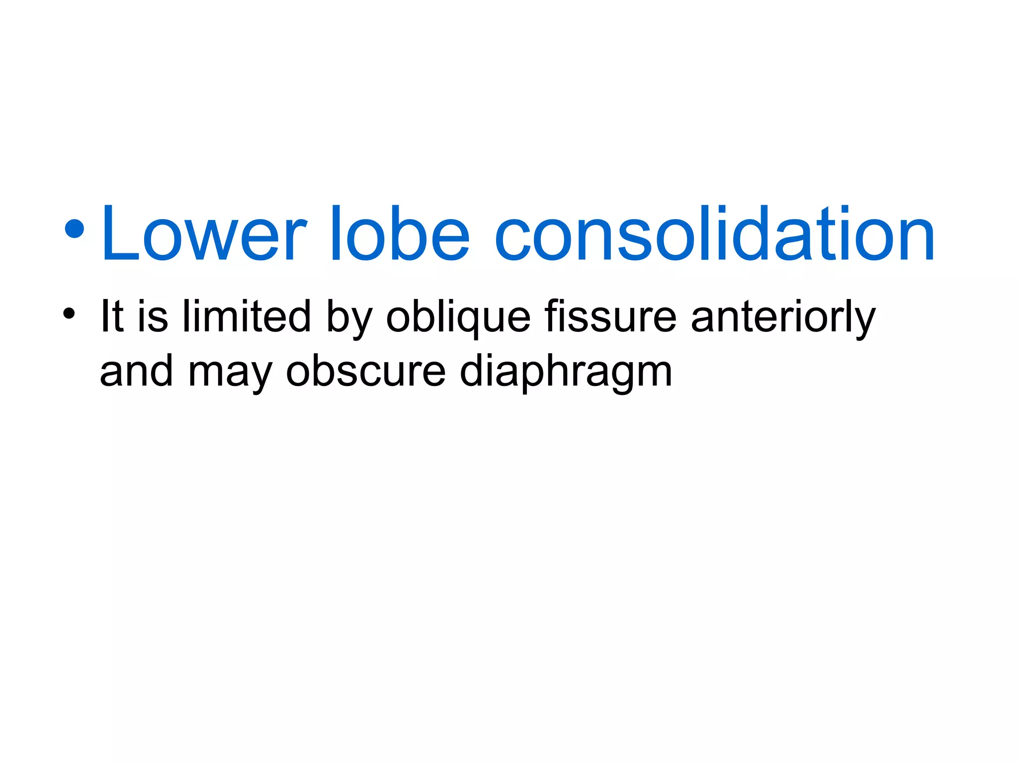 Collapse and consolidation Lung Radiology | PPT