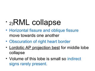 Collapse and consolidation Lung Radiology | PPT