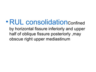 Collapse and consolidation Lung Radiology | PPT