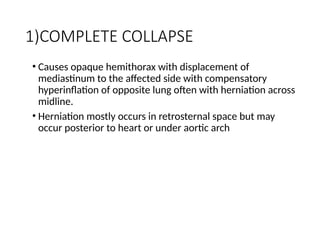 Collapse and Consolidation Pathology and radiology | PPTX