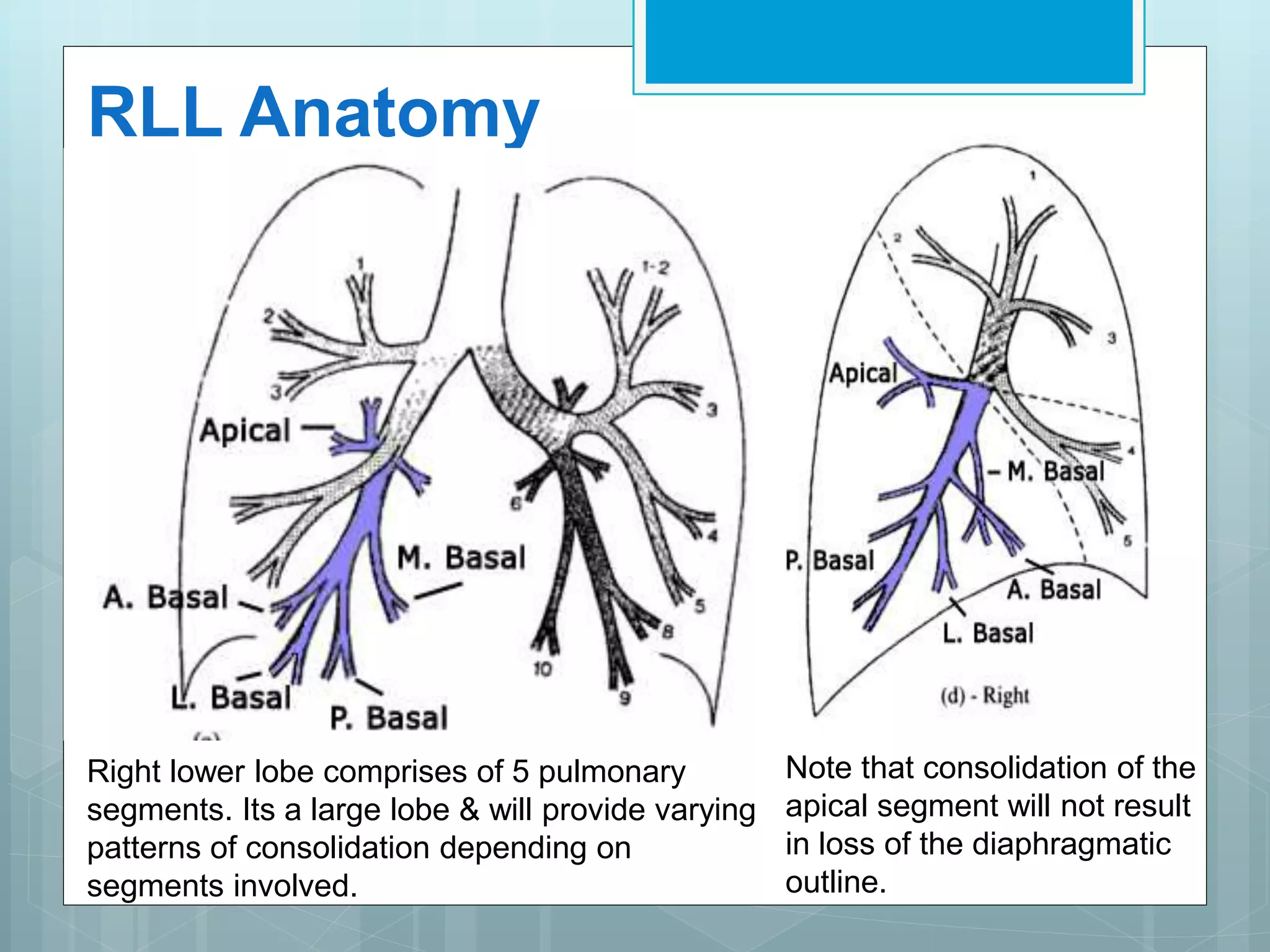 Collapse consolidation | PPTX