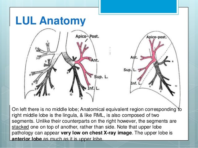 Collapse consolidation