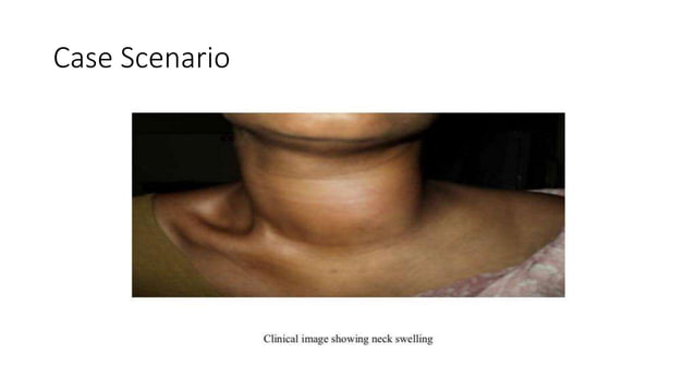 Collar stud abscess | PPTX | Diseases and Conditions | Medical Health