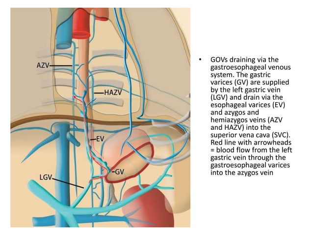 Collateral pathways in portal hypertension | PPTX