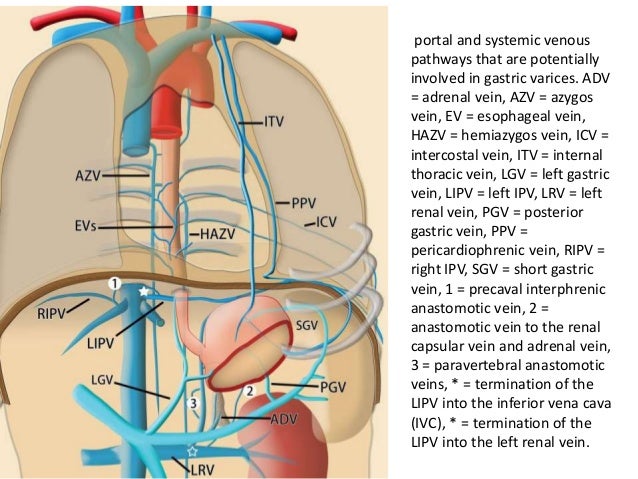 Collateral pathways in portal hypertension