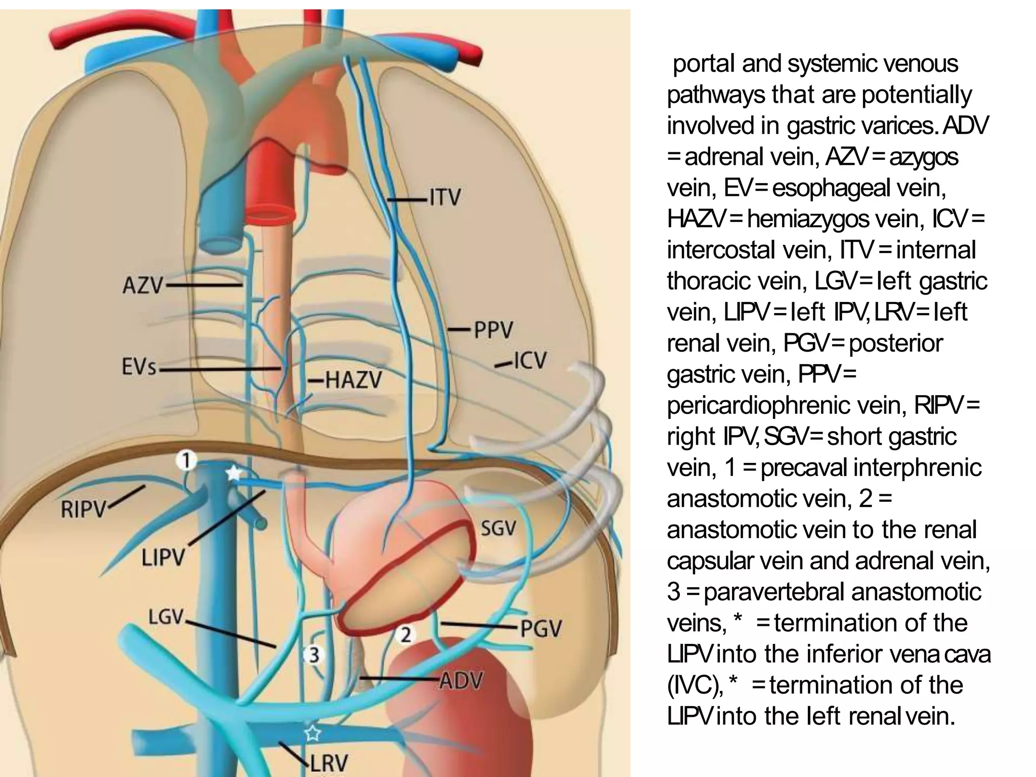 collaterals in PHTN.pptx