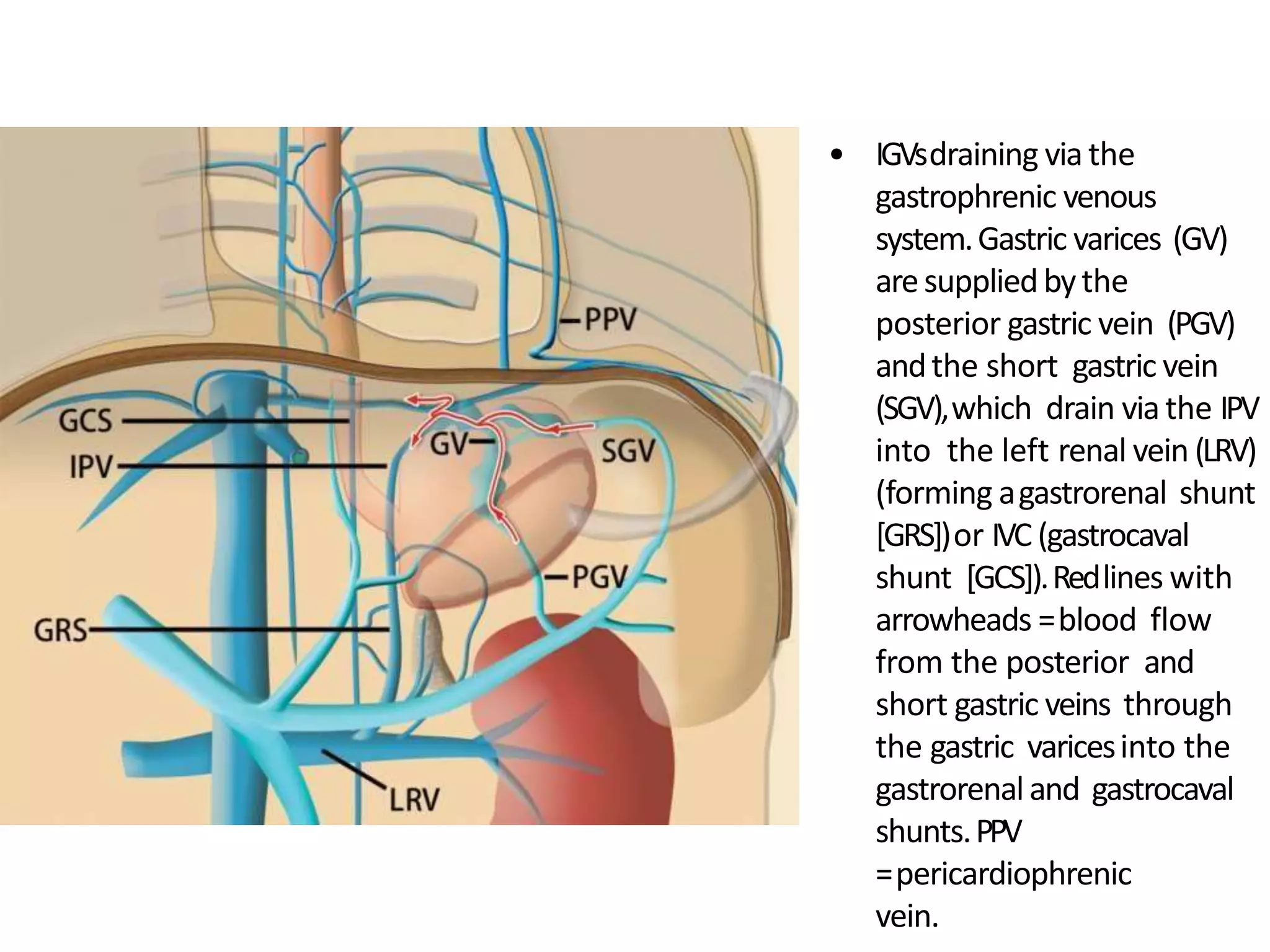 collaterals in PHTN.pptx