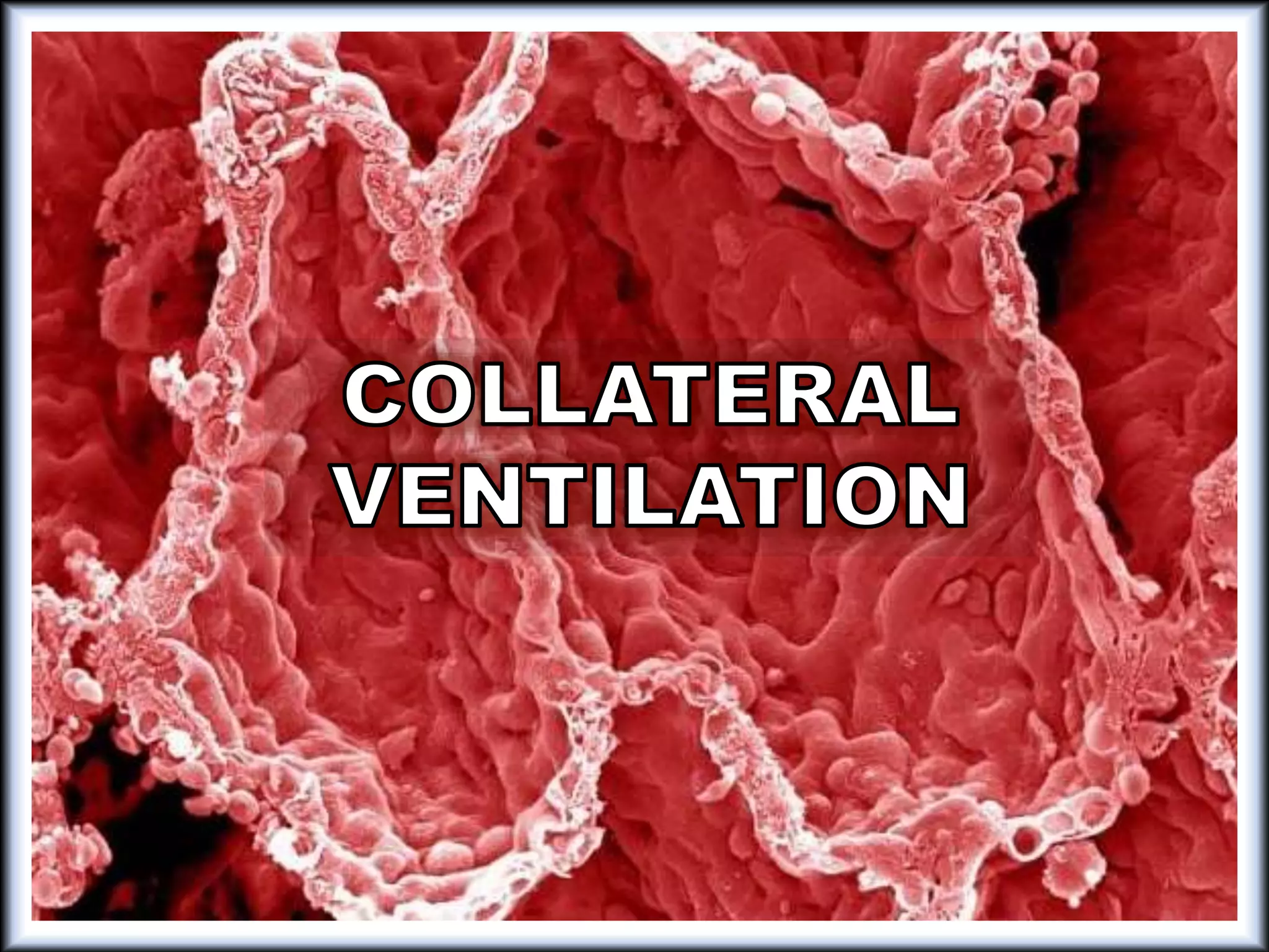 Collateral ventilation | PPTX