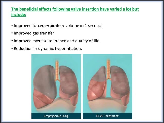 Collateral ventilation | PPTX | Lung and Respiratory Health | Diseases ...