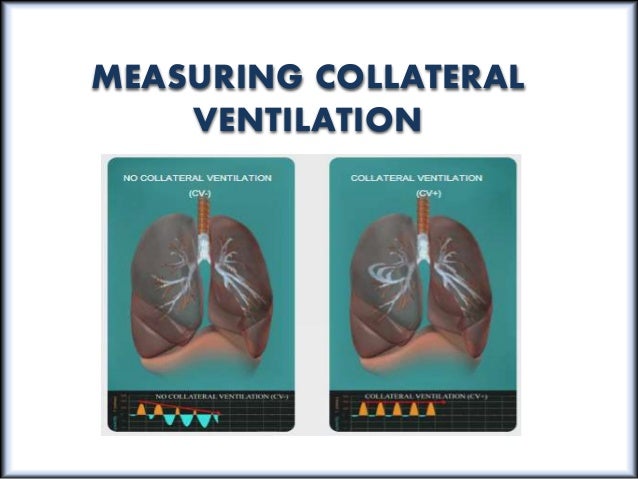 Collateral ventilation