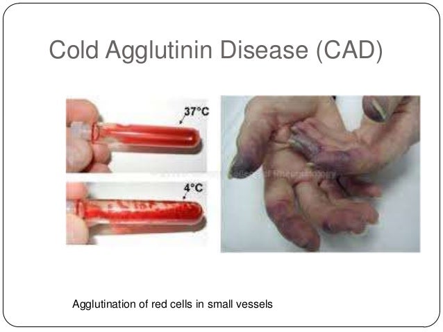 Colleague education hurdle