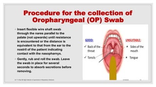 Biosafety in Collecting laboratory specimens in respiratory tract ...