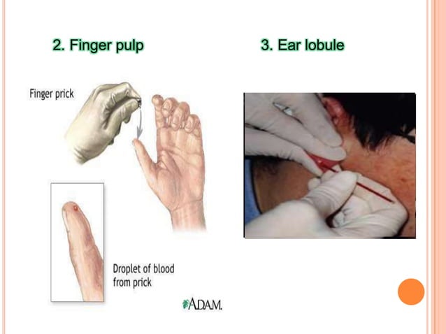 Collection and handling of blood