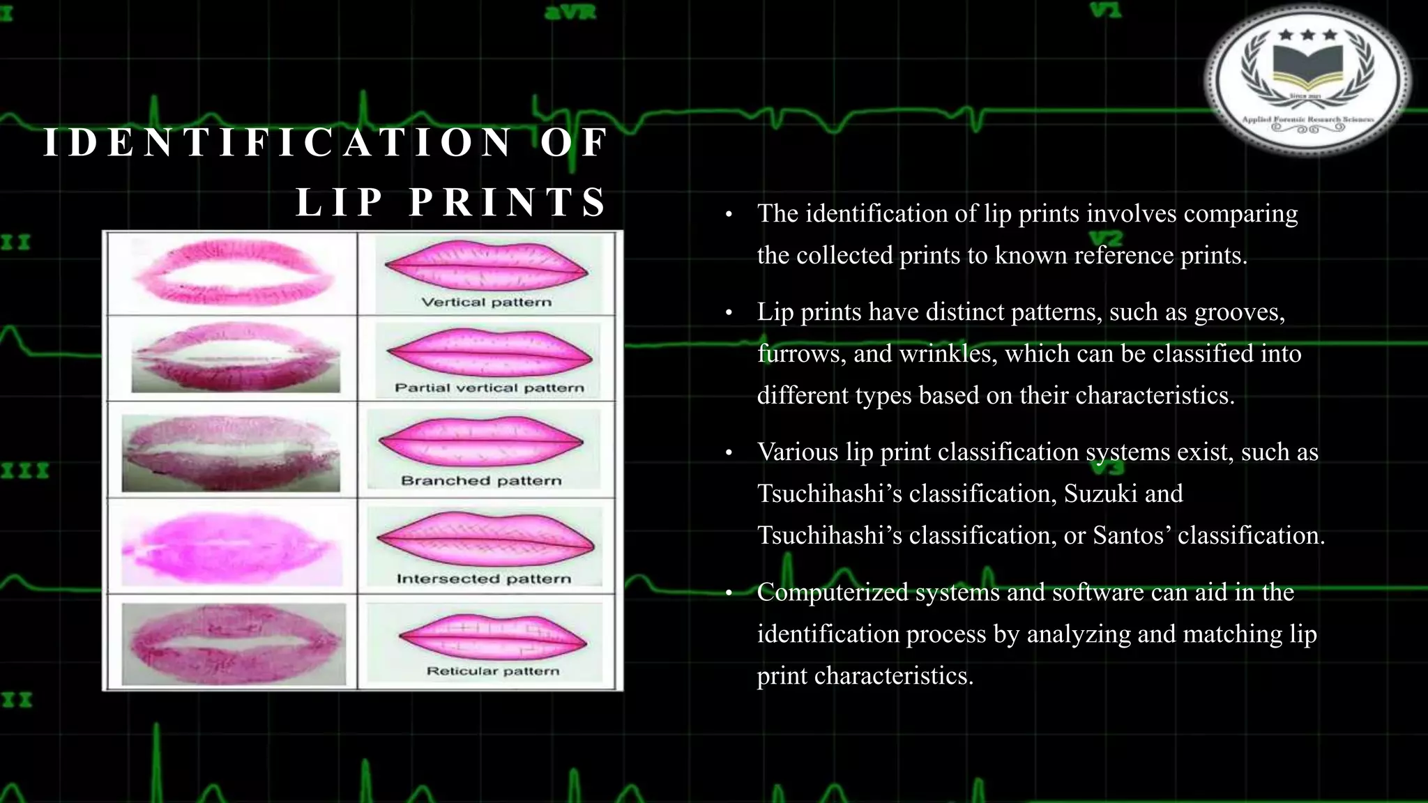Collection, Identification & Comparison of Lip prints | PPTX