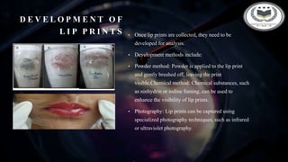 Collection, Identification & Comparison of Lip prints | PPTX