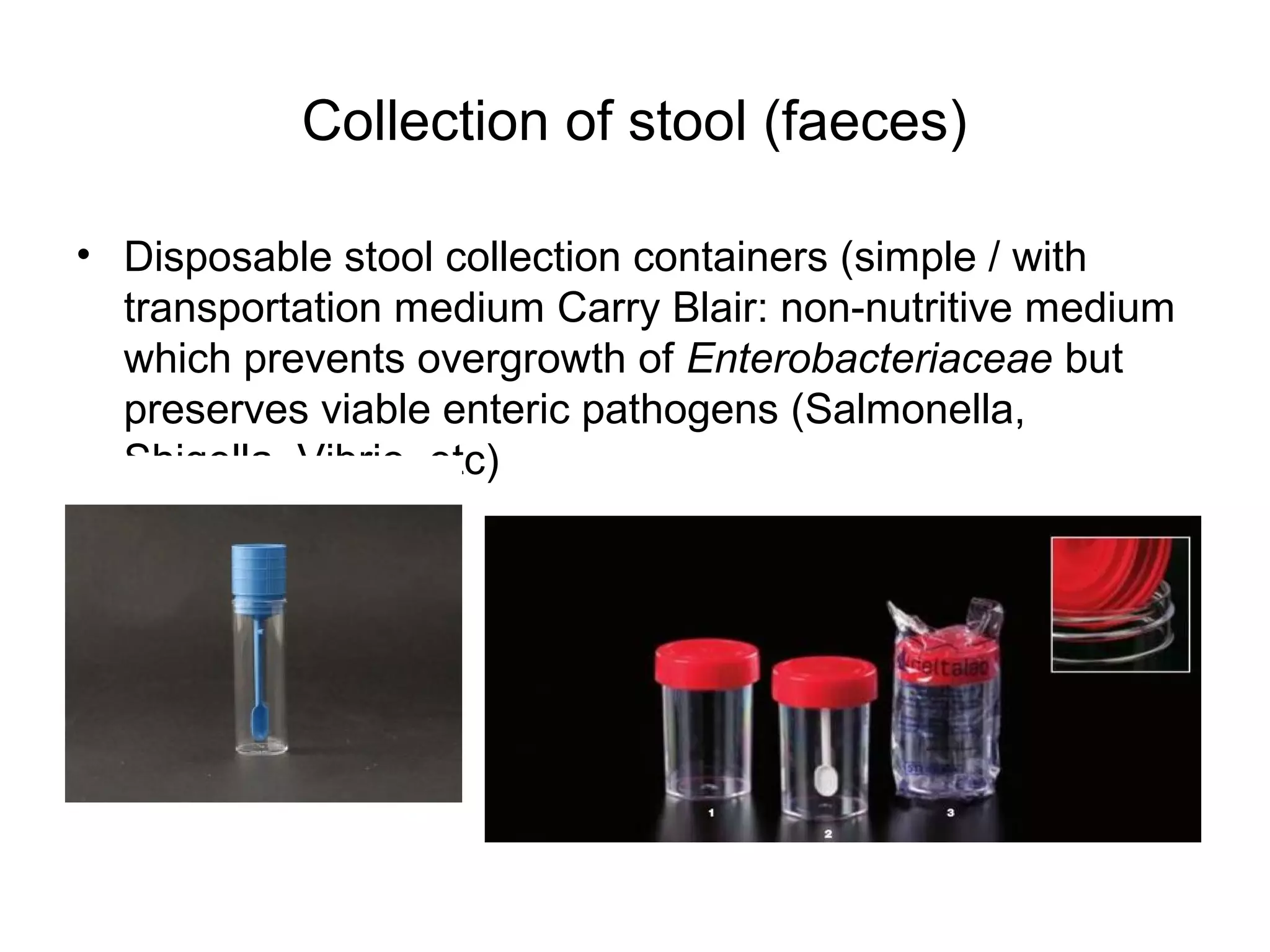 Collection of biological specimens for microbiology tests | PPT