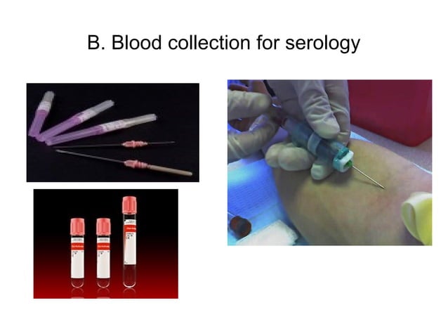 Collection of biological specimens for microbiology tests | PPT | Blood ...