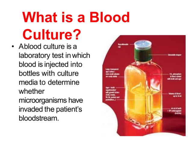 collection of blood culture.pptx