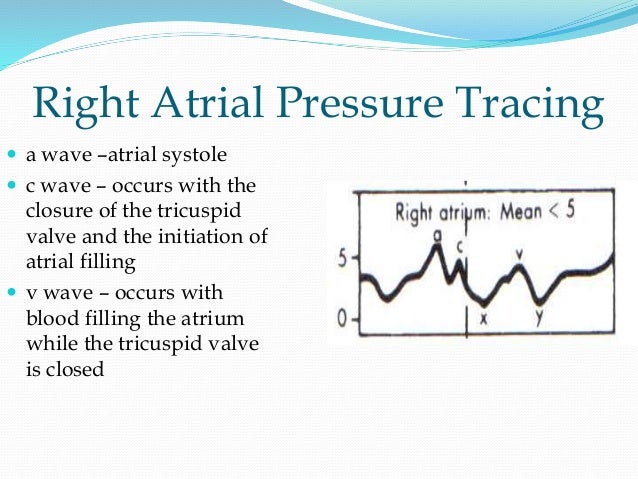 Collection of cathtracings,Dr Virbhan