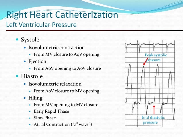 Collection of cath tracings by navin