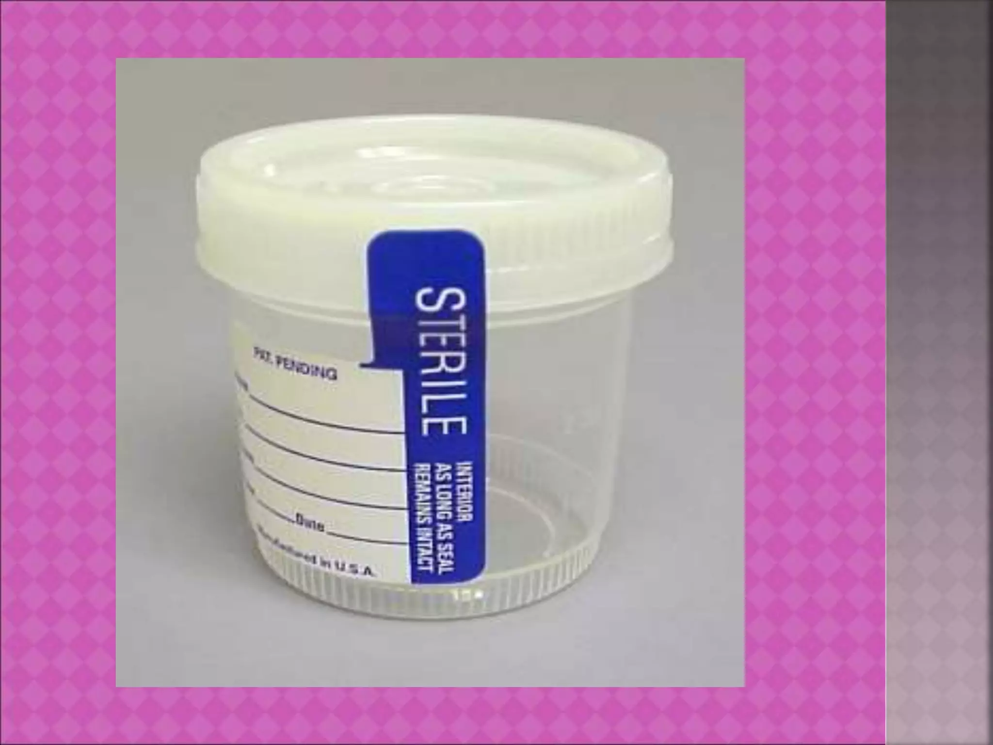 Collection of specimen in children. | PPT