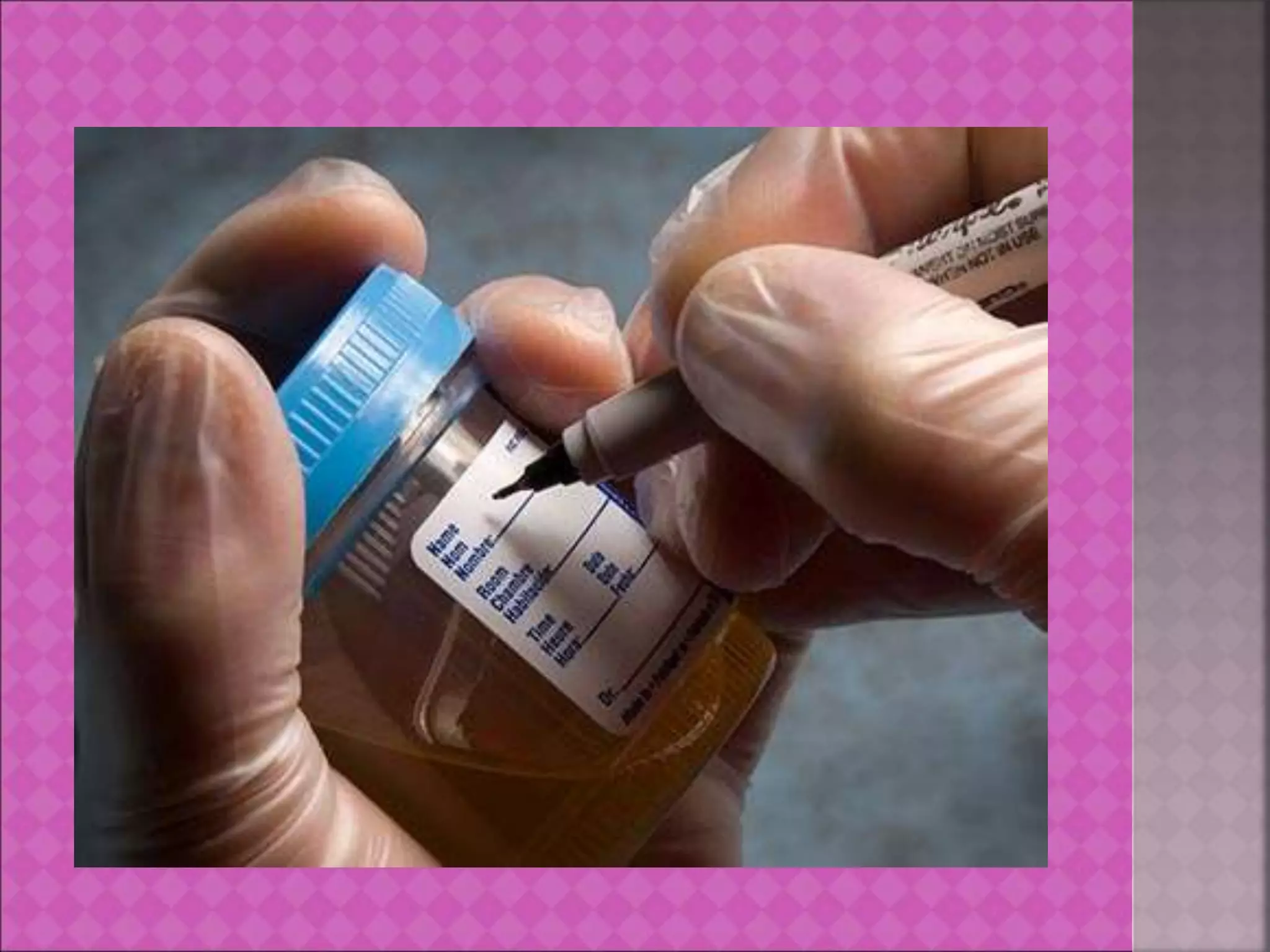 Collection of specimen in children. | PPT