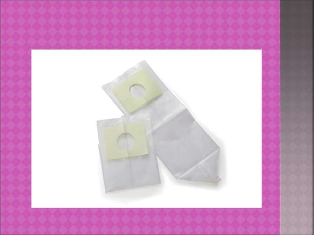 Collection of specimen in children. | PPT