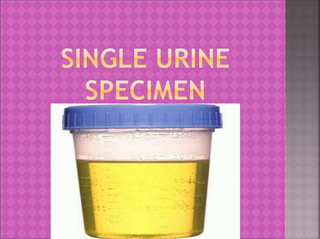 Collection of specimen in children. | PPT