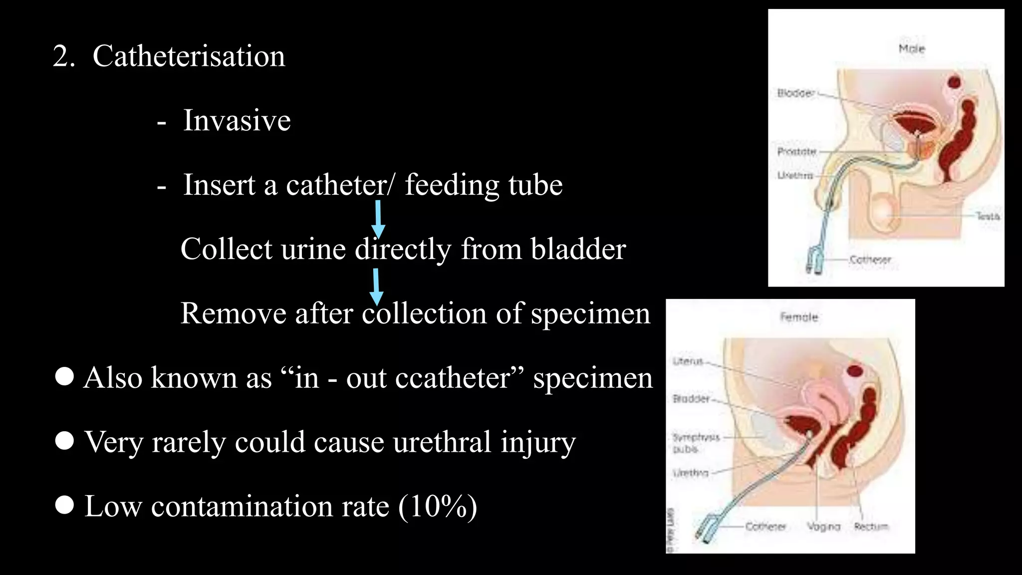 Collection of urine sample | PPTX
