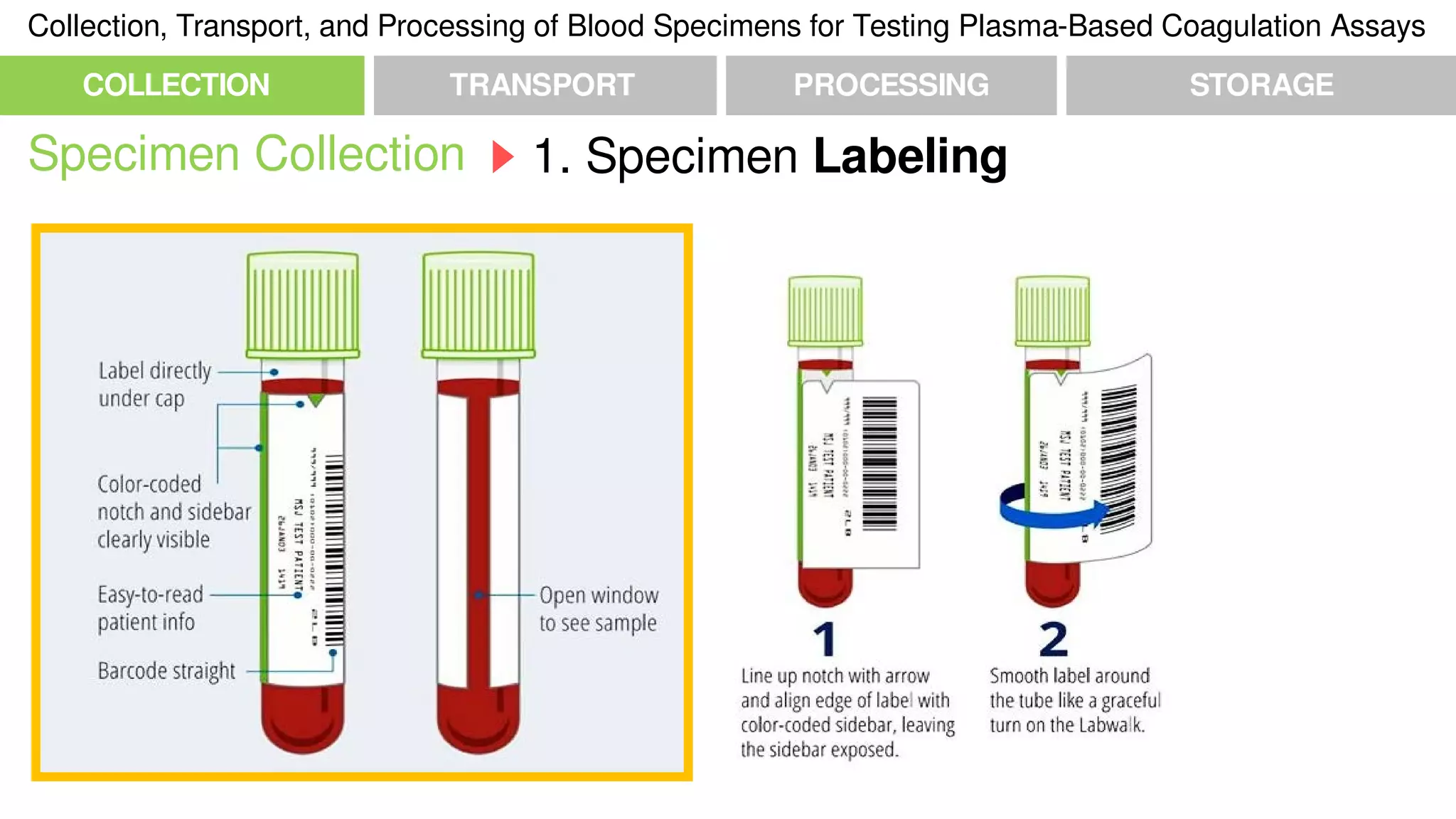Collection, transport, and processing of blood specimens for testing ...