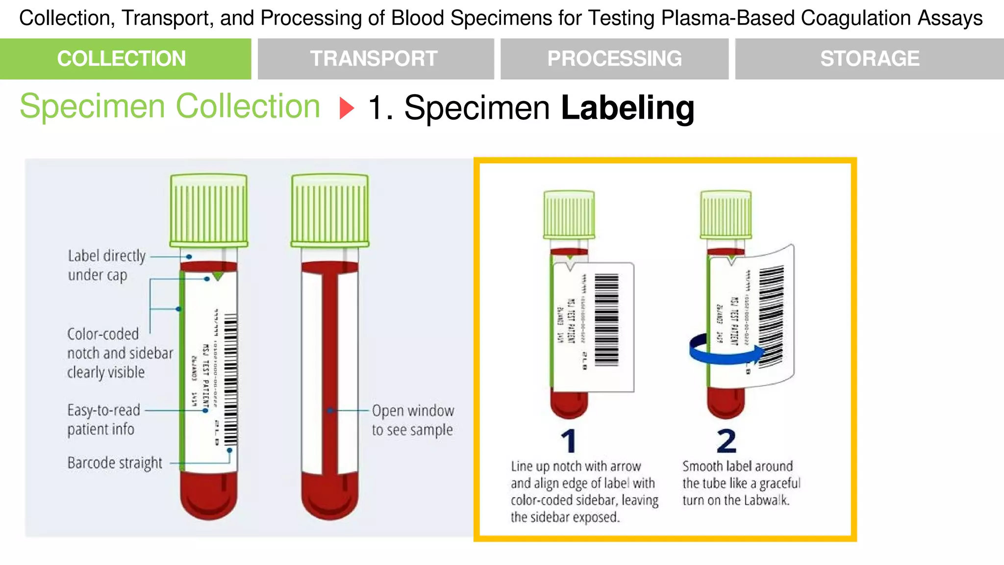 Collection, transport, and processing of blood specimens for testing ...