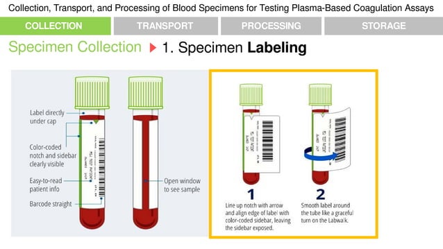 Collection, transport, and processing of blood specimens for testing ...
