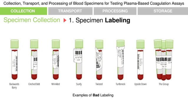 Collection, transport, and processing of blood specimens for testing ...