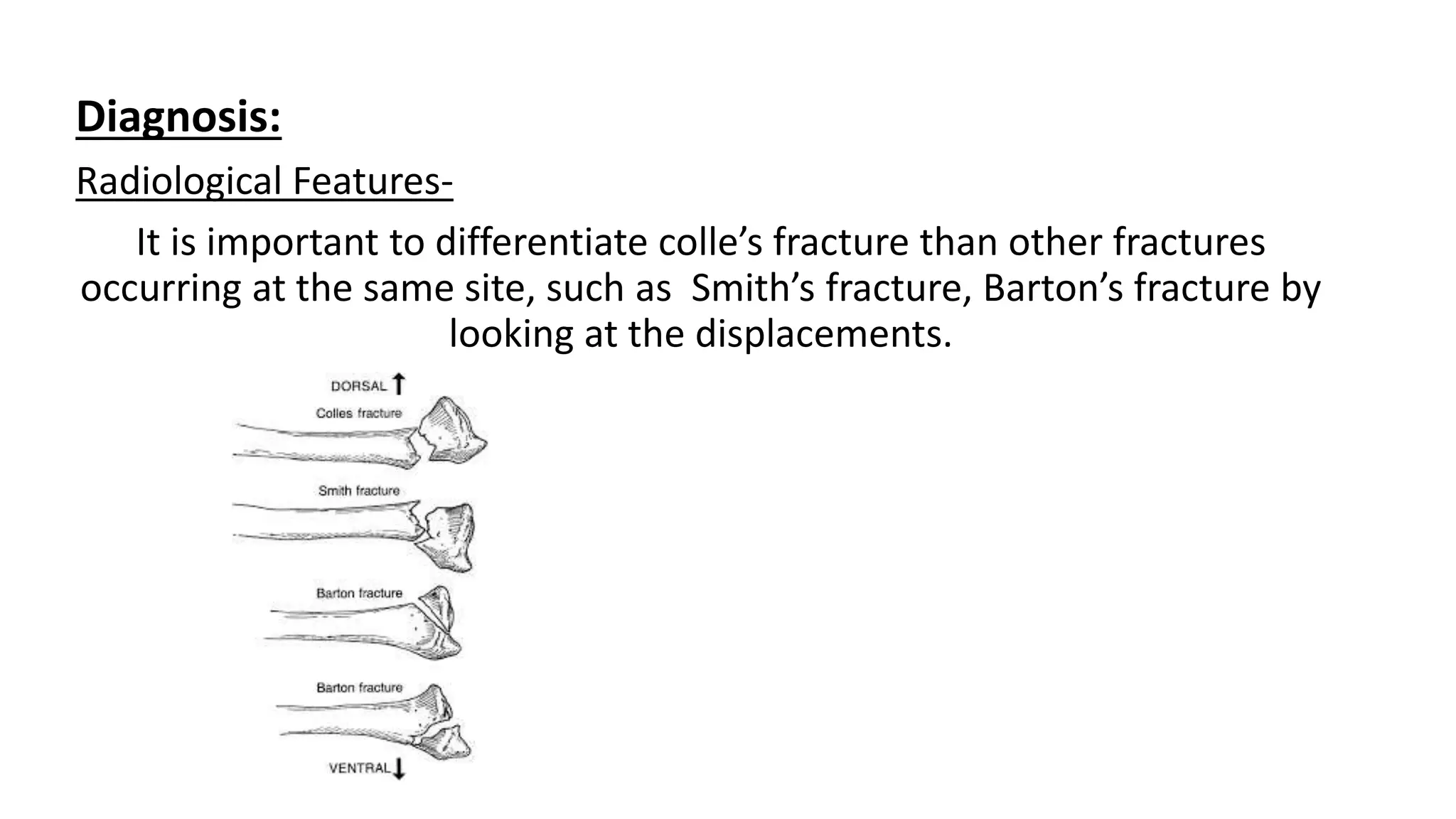 Colles fracture | PPTX