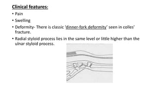Colles fracture | PPTX
