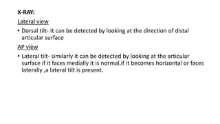 Colles fracture | PPTX