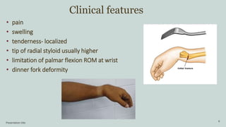 Colle’s Fracture.pptx