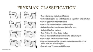 Colle’s Fracture.pptx