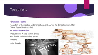 colle's fracture.pptx
